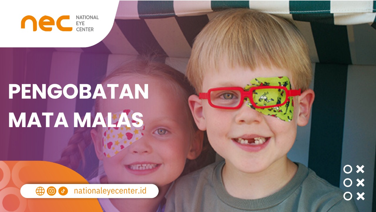 Mata Malas (Ambliopia) – Penyebab, Gejala, dan Pengobatan