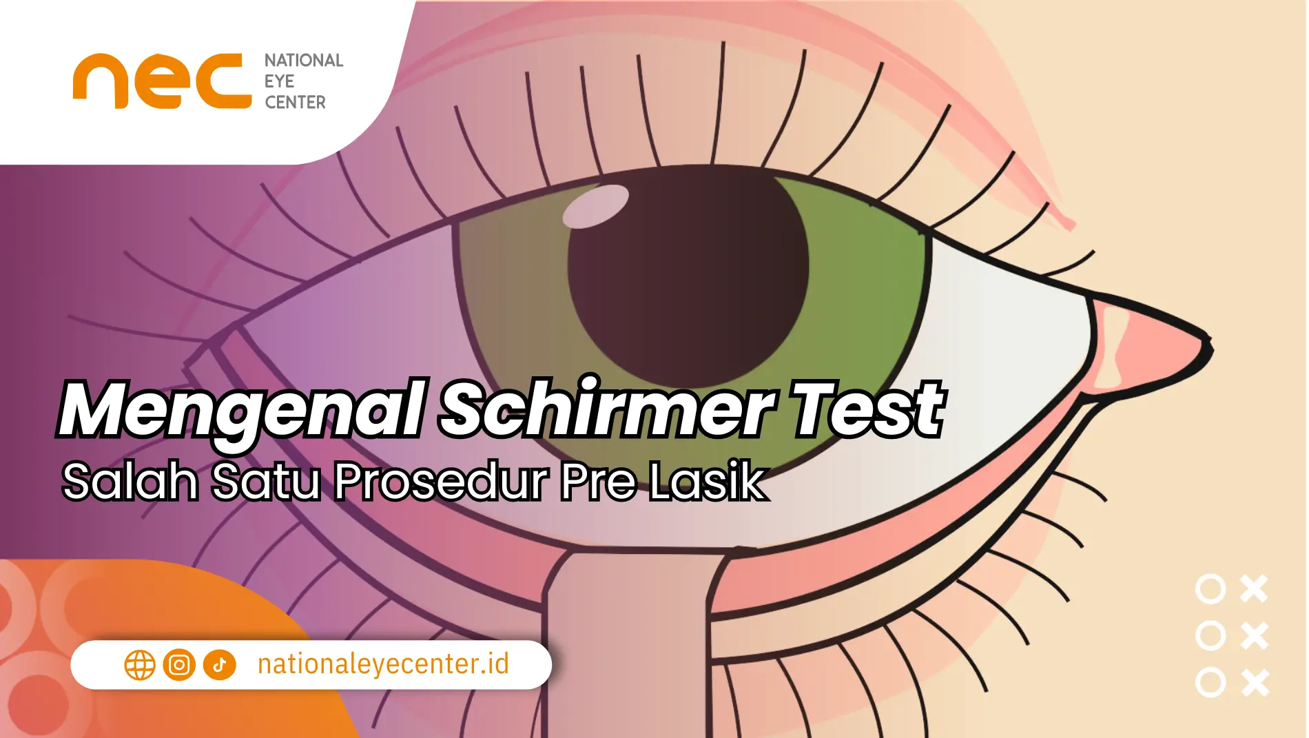 Mengenal Schirmer Test, Salah Satu Prosedur Pre Lasik