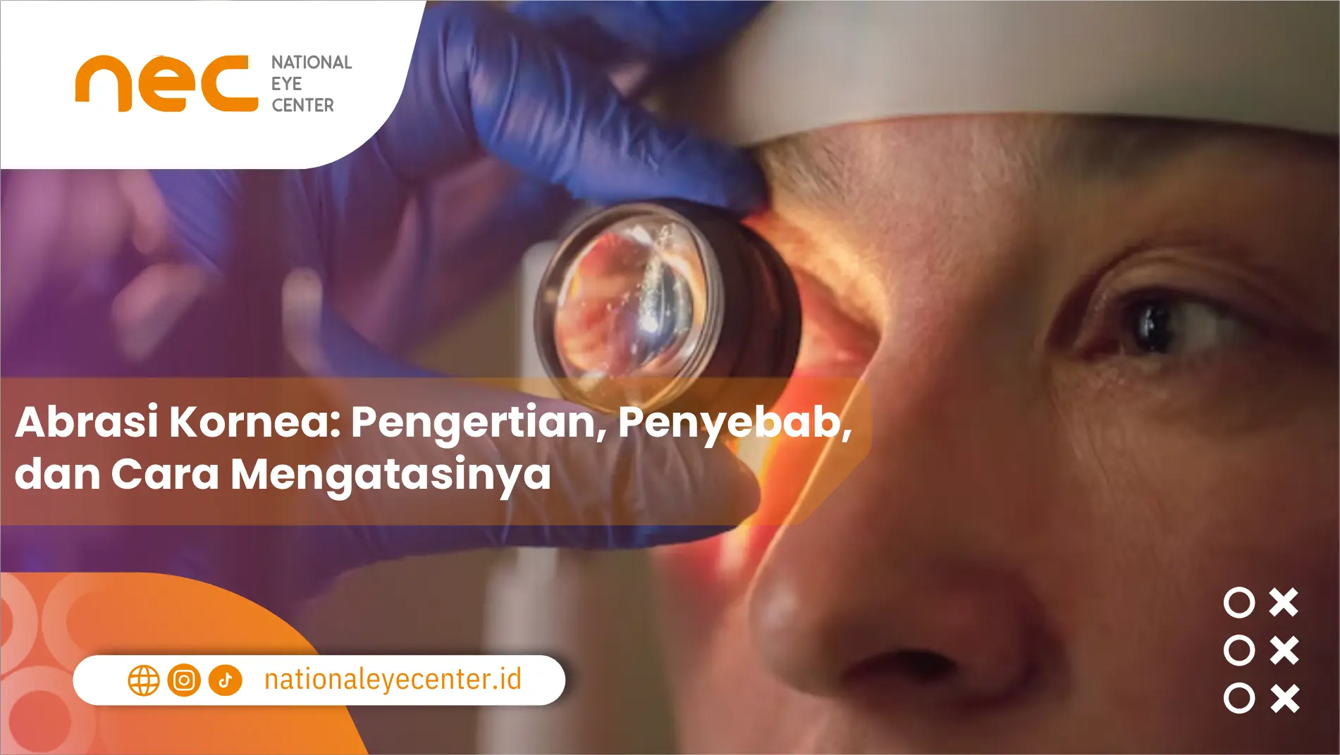 8 Penyebab Abrasi Kornea dan Cara Mengatasinya!