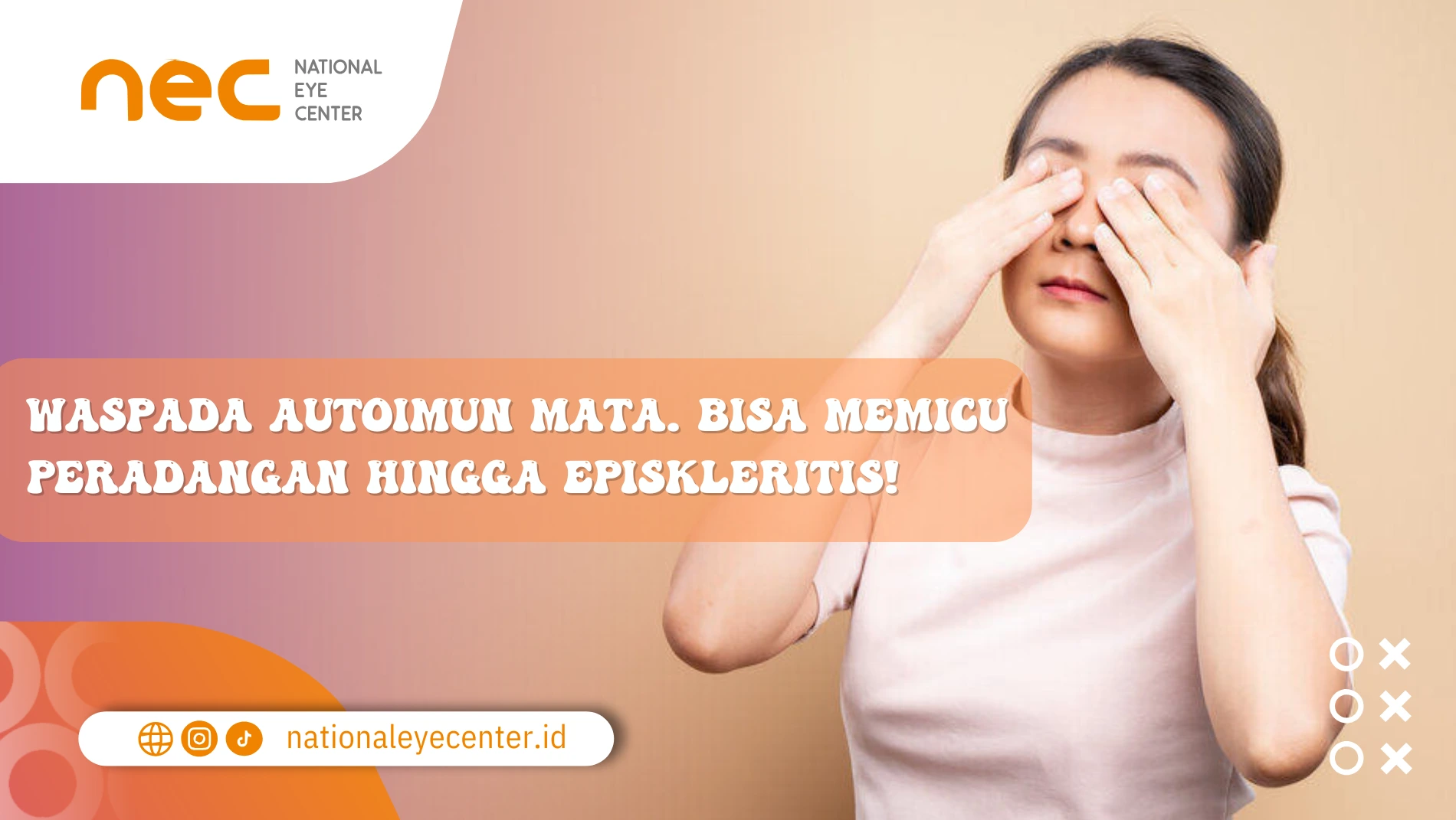 Waspada Autoimun Mata. Bisa Memicu Peradangan Hingga Episkleritis!